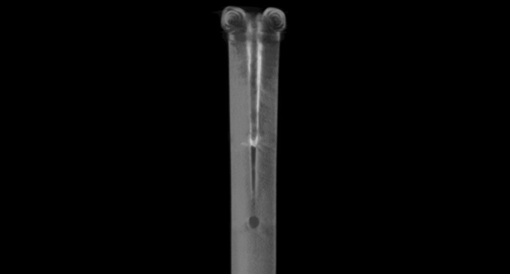 Ferramentas cirúrgicas de 2.000 anos revelam como era a medicina romana
