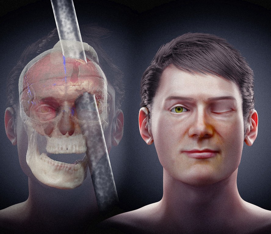 Brasileiro recria face de operário que sobreviveu a grave acidente em 1848