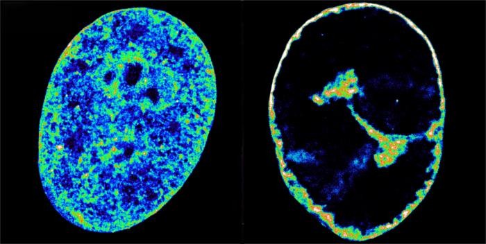 Estudo flagra como vírus do herpes altera interior das células humanas ...