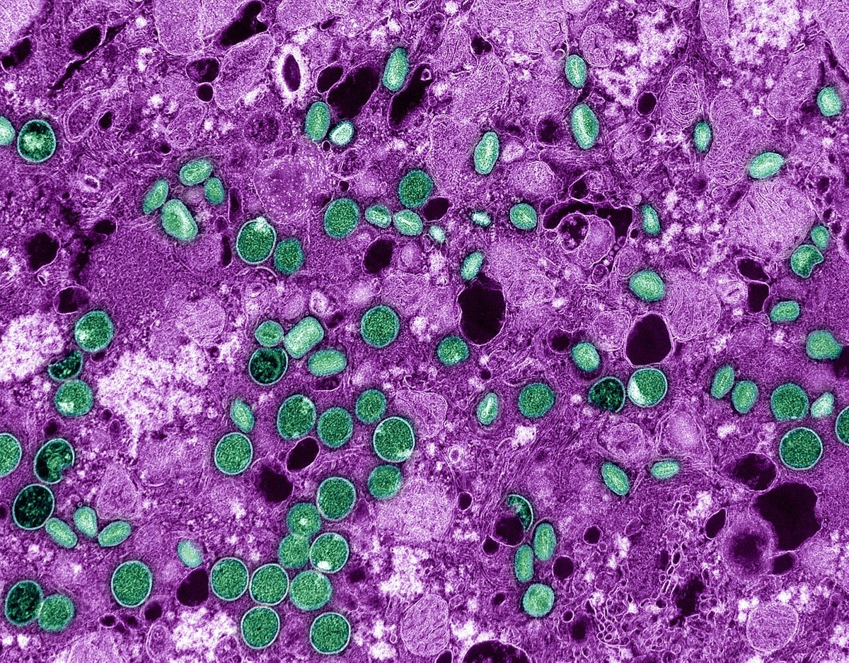 Ministério da Saúde cria centro de emergência para monitorar mpox no Brasil