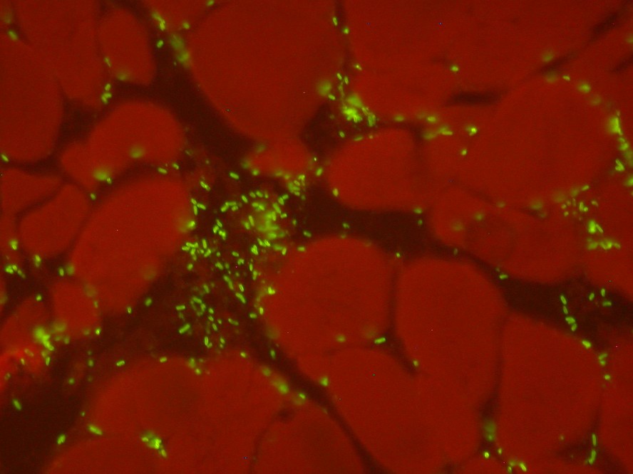 Mulher é 1ª sobrevivente de bactéria mortal; saiba como ela a contraiu ...