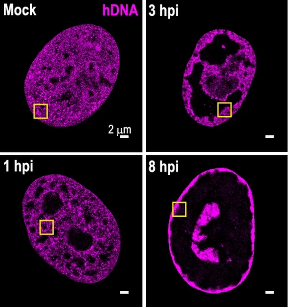 Estudo flagra como vírus do herpes altera interior das células humanas; imagens